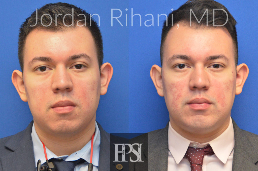 Chin.E.M - Facial Plastic Surgery Institute