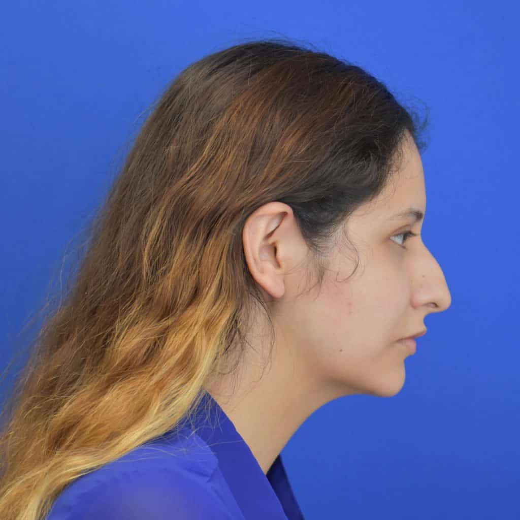 Internet Consultations - Facial Plastic Surgery Institute